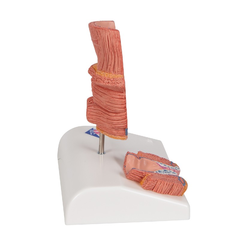 3B Scientific Rectum Model w/ Haemorrhoids | Health and Care